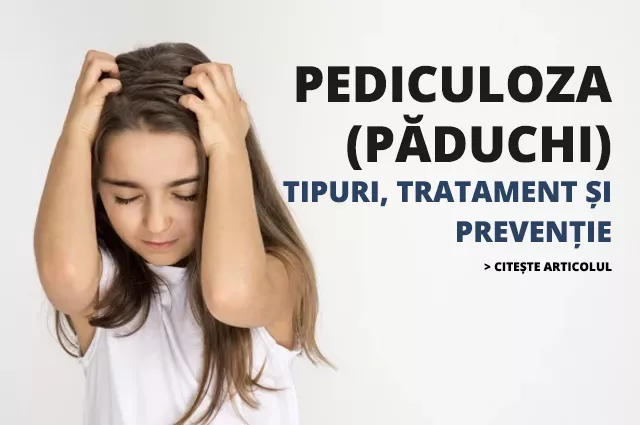 Copilul a luat păduchi? Tot ce trebui să știi pentru a scăpa de ei